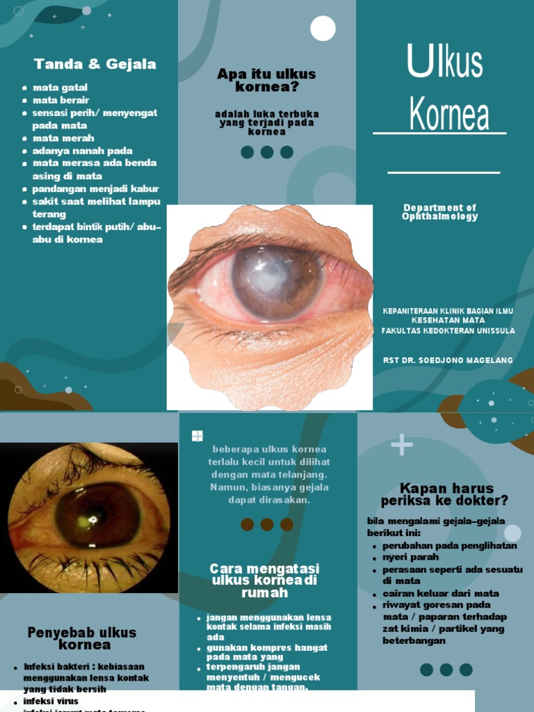 Gejala dan Penanganan Ulkus Kornea | PDF