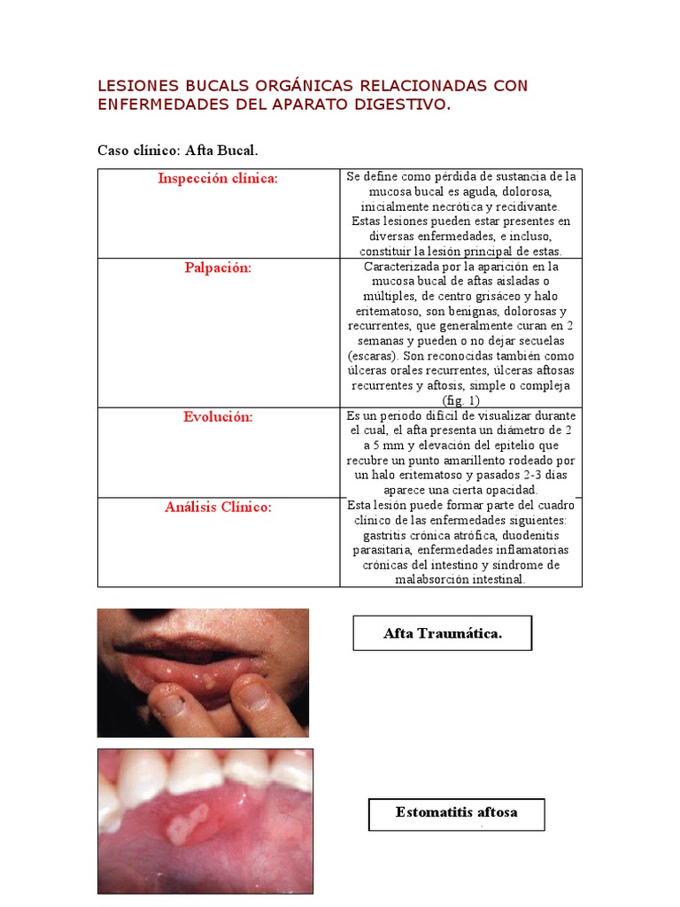 Aftas bucales: causas y tratamiento | PDF | Condiciones cutáneas ...