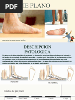 Comparativa: Ángulos de Meary y Costa-Bartani | PDF | Pie | Sistema ...