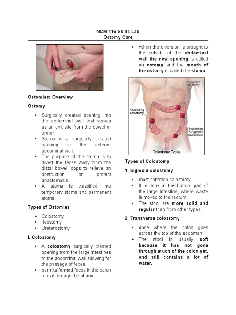 Types and Care of Ostomies | PDF