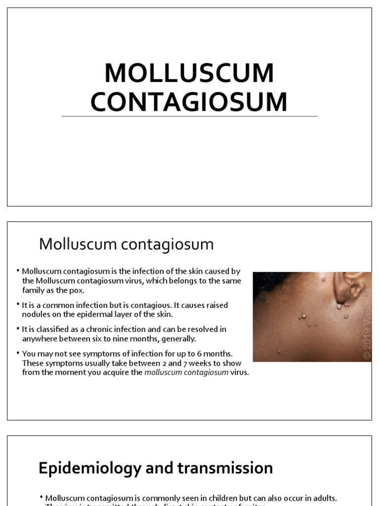 Molluscum Contagiosum | PDF | Clinical Medicine | Cutaneous Conditions