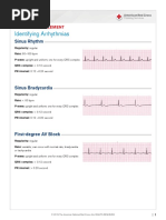 ICU One Pager External Pacemakers v11 | PDF | Artificial Cardiac ...