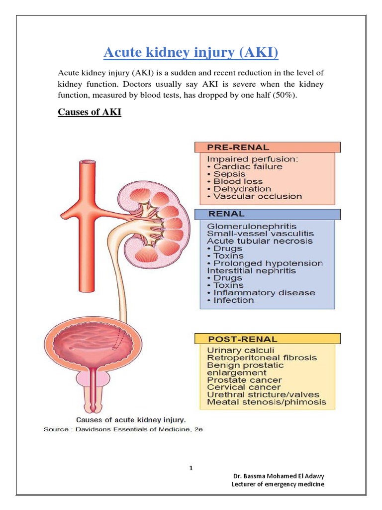 Acute Kidney Injury | PDF