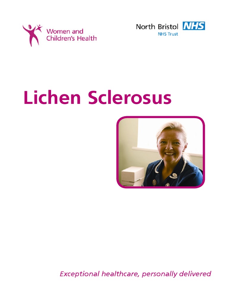Lichen Sclerosus Nbt002510 Pdf Skin Dermatology