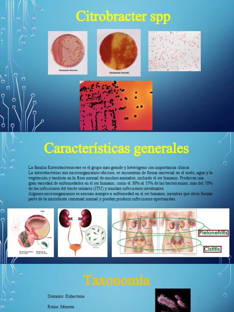 Citrobacter | PDF | Salud y bienestar | Tecnología