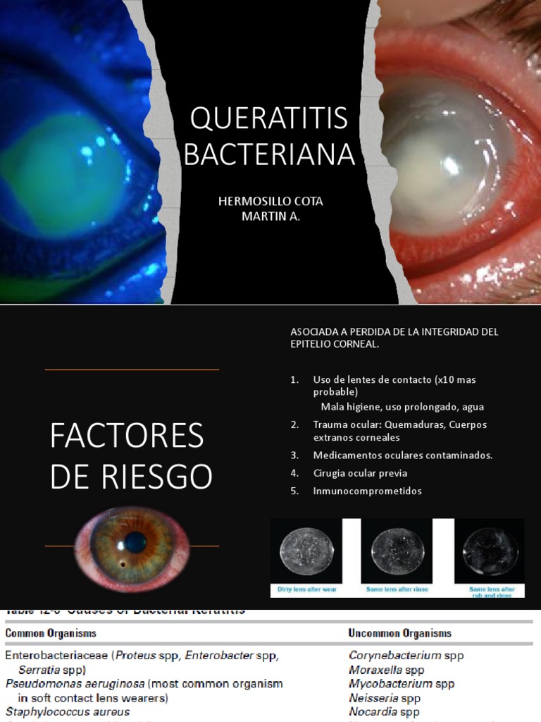 Queratitis | PDF | Córnea | Ojo humano