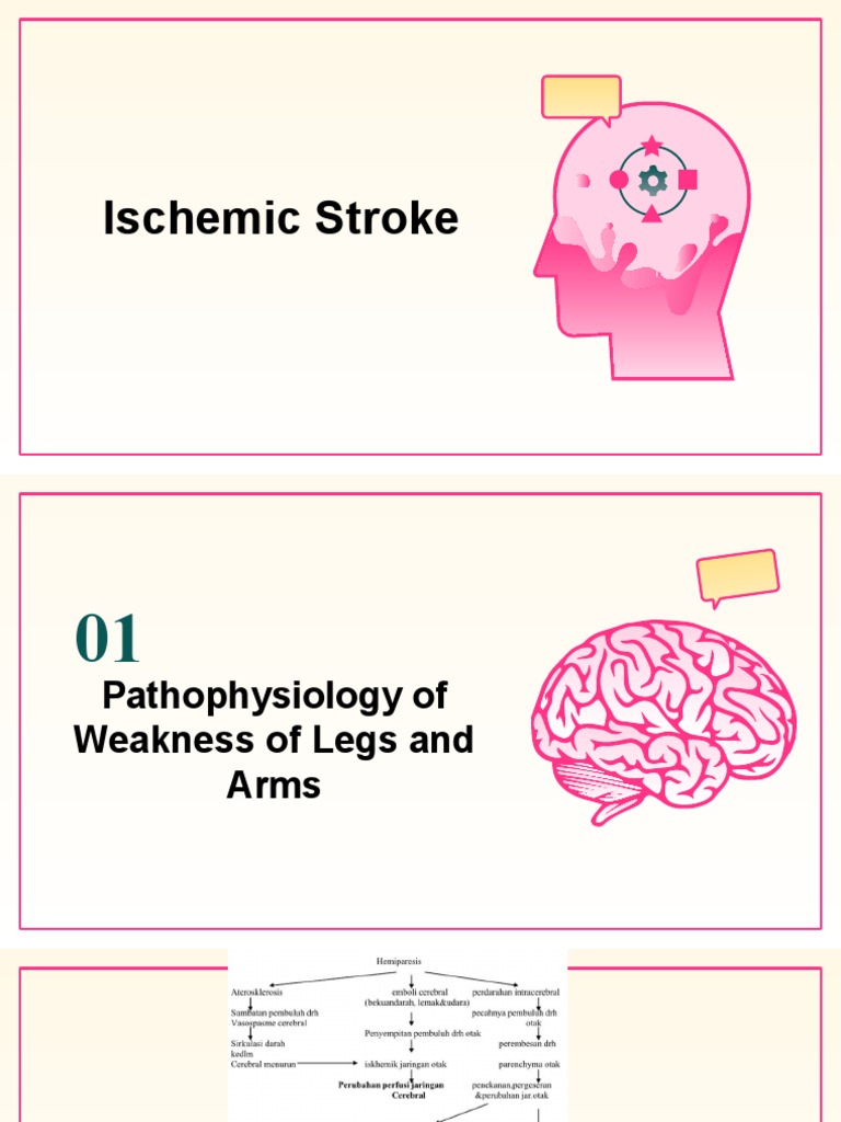 Stroke Iskemik Inggris | PDF