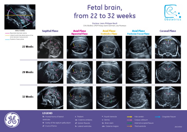 Fetal | PDF