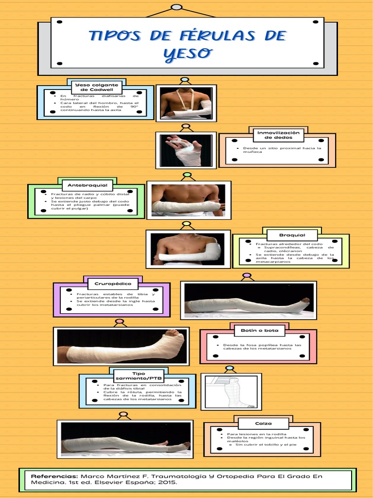 Tipos de Férulas de Yeso en Traumatología | PDF | Codo | Rodilla