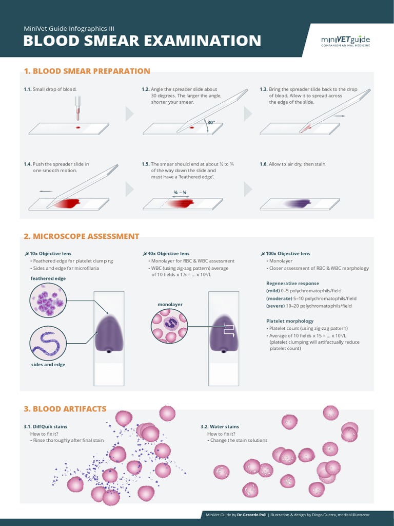 Infographics III Blood Smear 27 07 2020 | PDF | Anatomy | Clinical ...