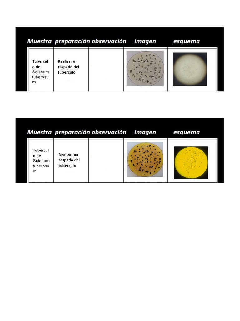 Papa Con Agua y Lugol | PDF