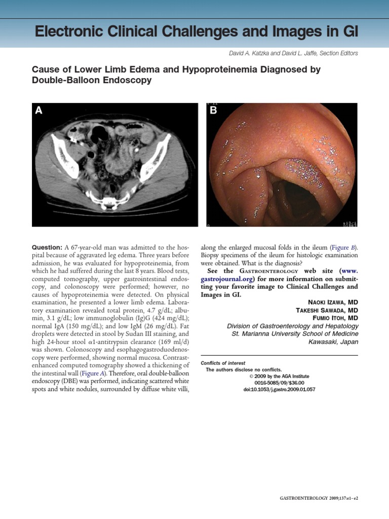 Cause of Lower Limb Edema and Hypoproteinemia Diag | PDF ...