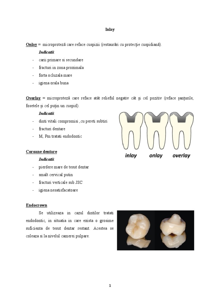 Inlay Dental Prosthetics | PDF