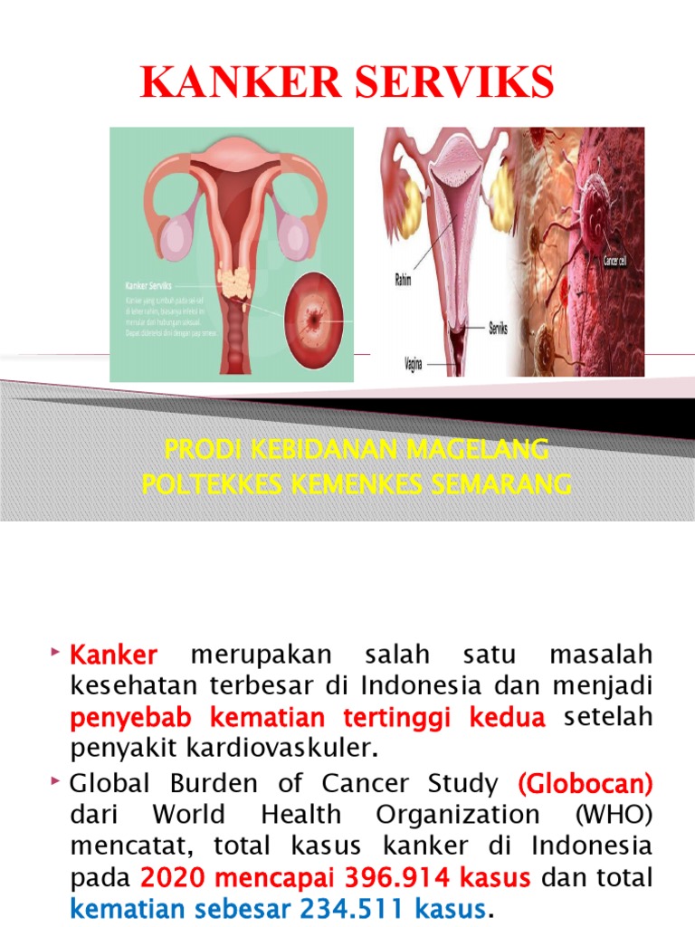 Kanker Serviks | PDF