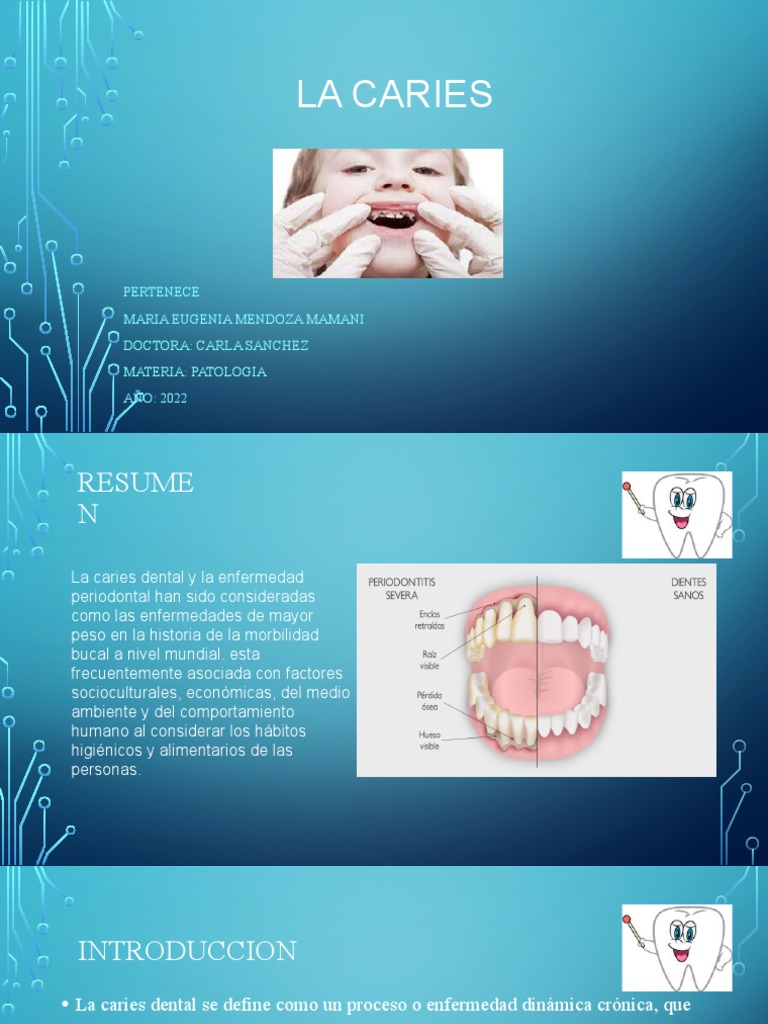 CARIES | PDF | Diente | Especialidades Medicas