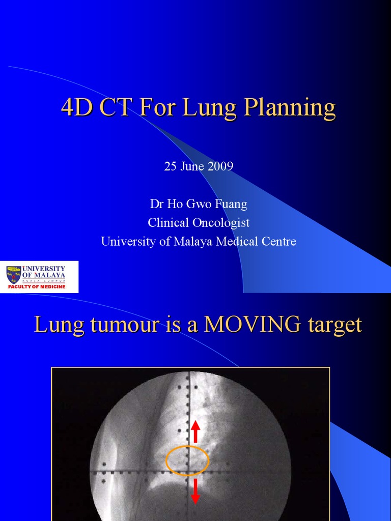 05-4d CT Lung Planning | PDF | Radiation Therapy | Ct Scan