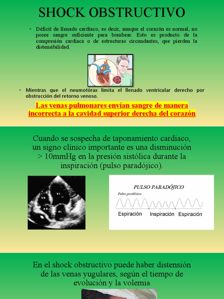 SHOCK OBSTRUCTIVO Powerpoint | PDF