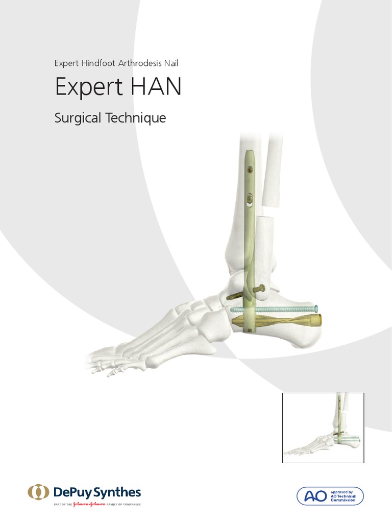 Expert HAN: Surgical Technique | PDF | Technology & Engineering