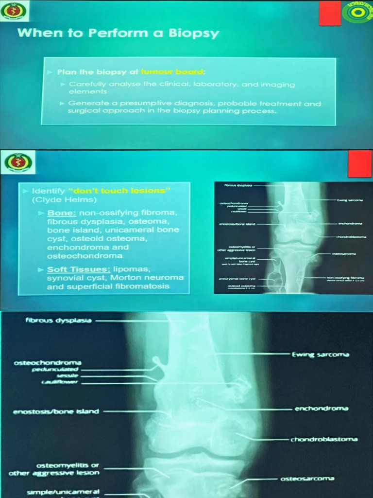 Biopsy Principles | PDF