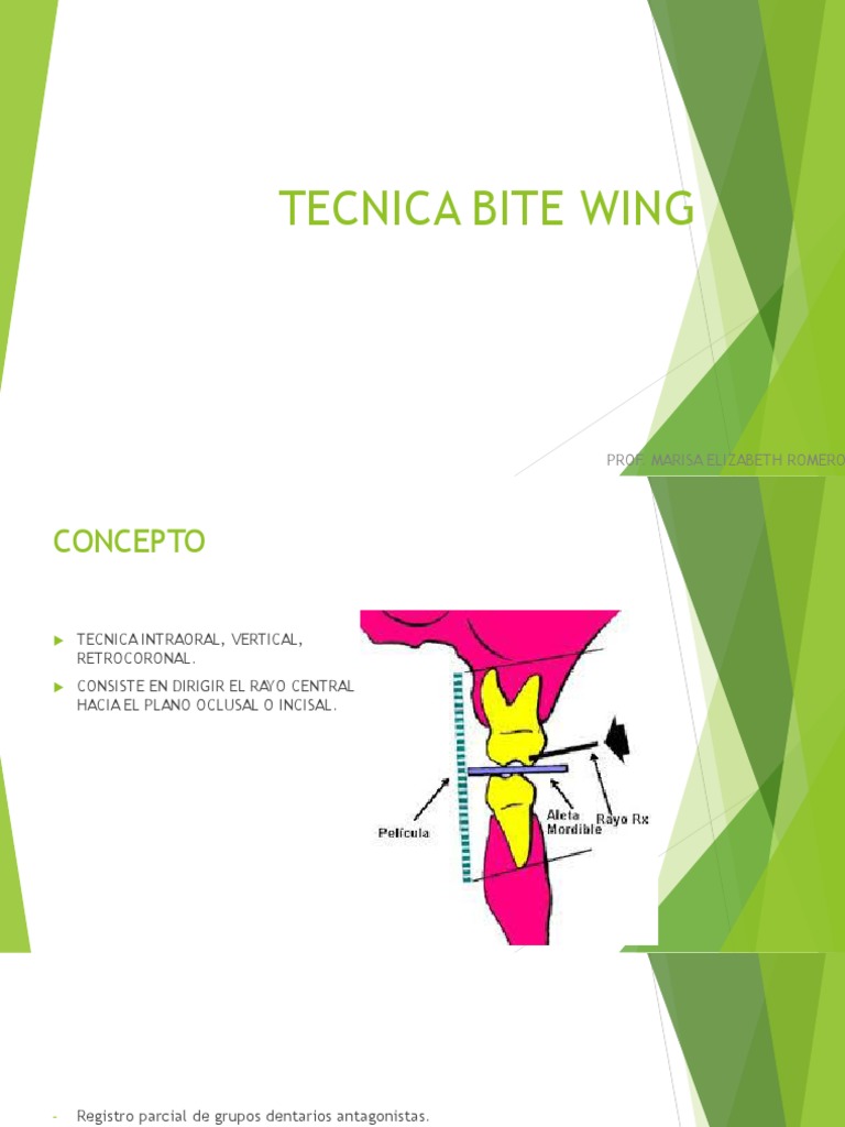 Técnica Radiográfica Bite Wing | PDF