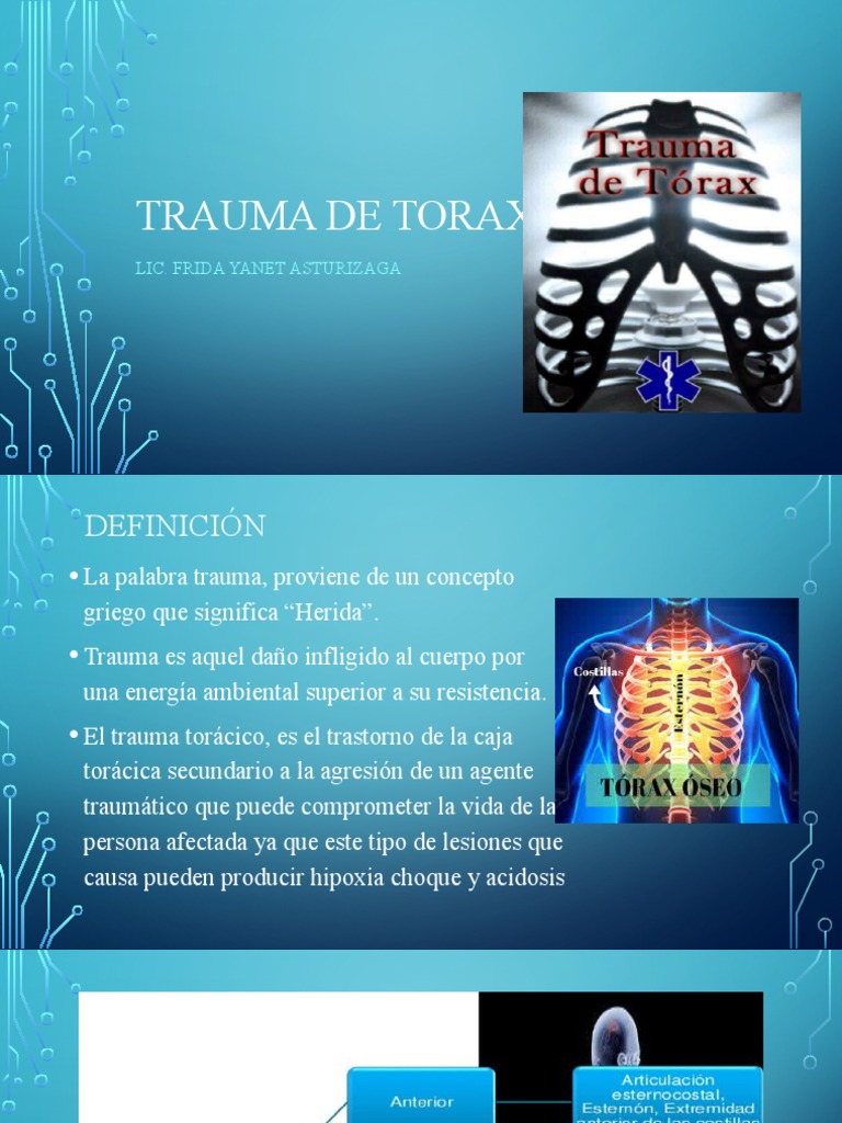 Trauma de Torax | PDF