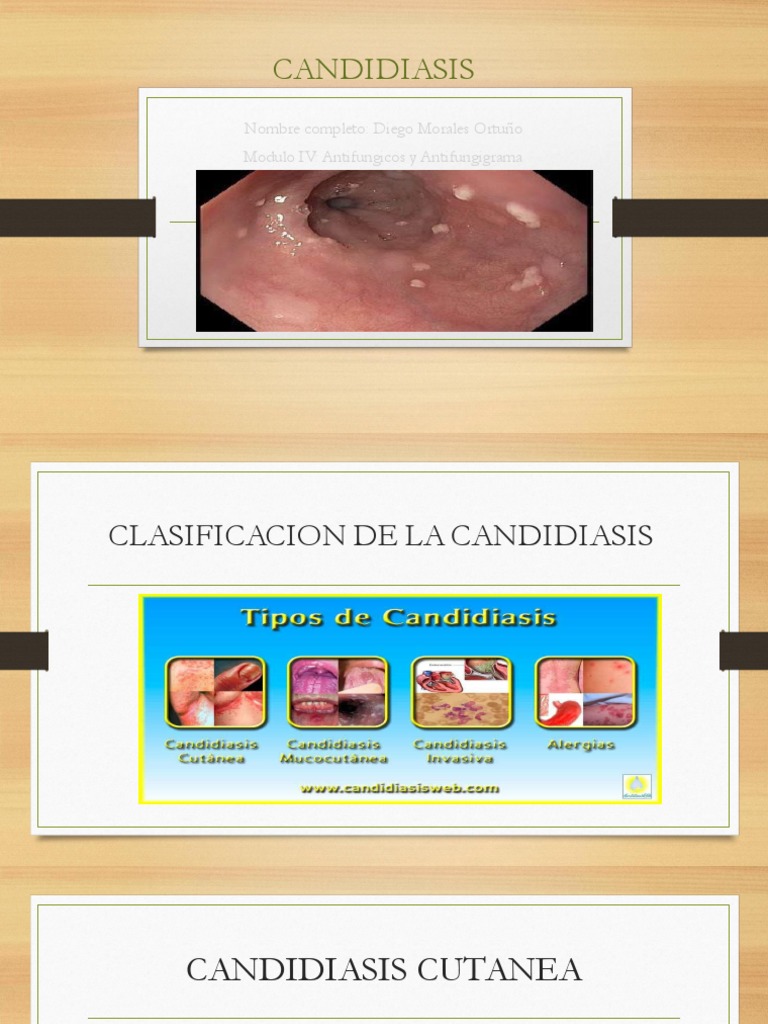 CANDIDIASIS | PDF