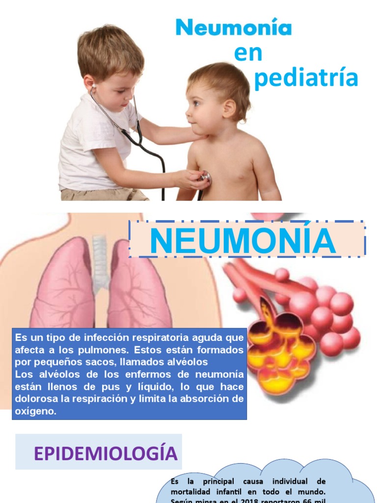 Neomonia en PX Pediatrico 2023 I | PDF