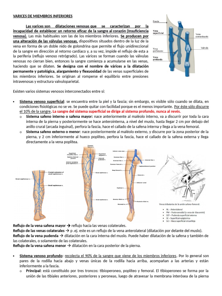 Varices De Miembros Inferiores Pdf Venas Varicosas Edema