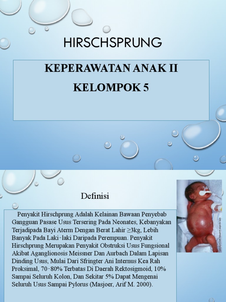 Hisprung | PDF