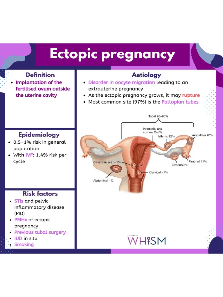 Ectopic Pregnancy | PDF