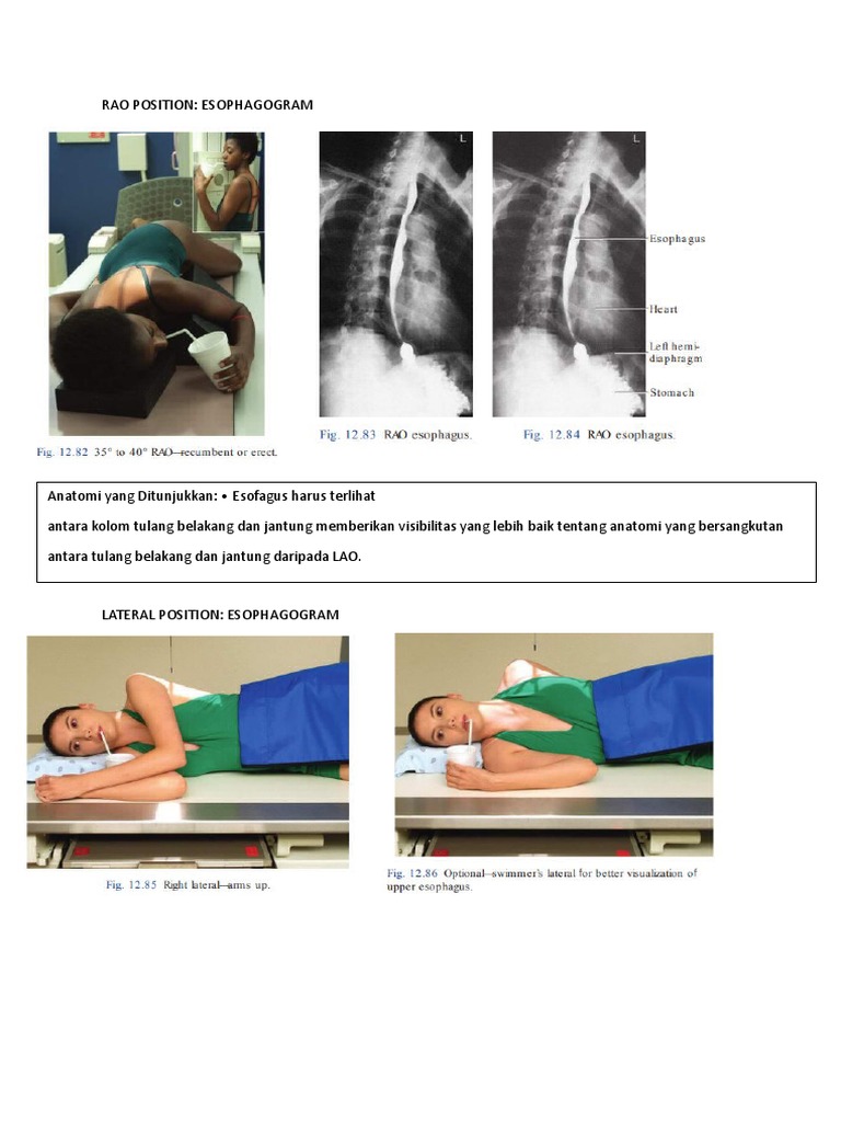 Pemeriksaan Esofagus | PDF