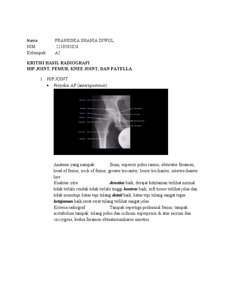 Kritisi Hip Joint, Femur, Knee Joint, Dan Patella | PDF