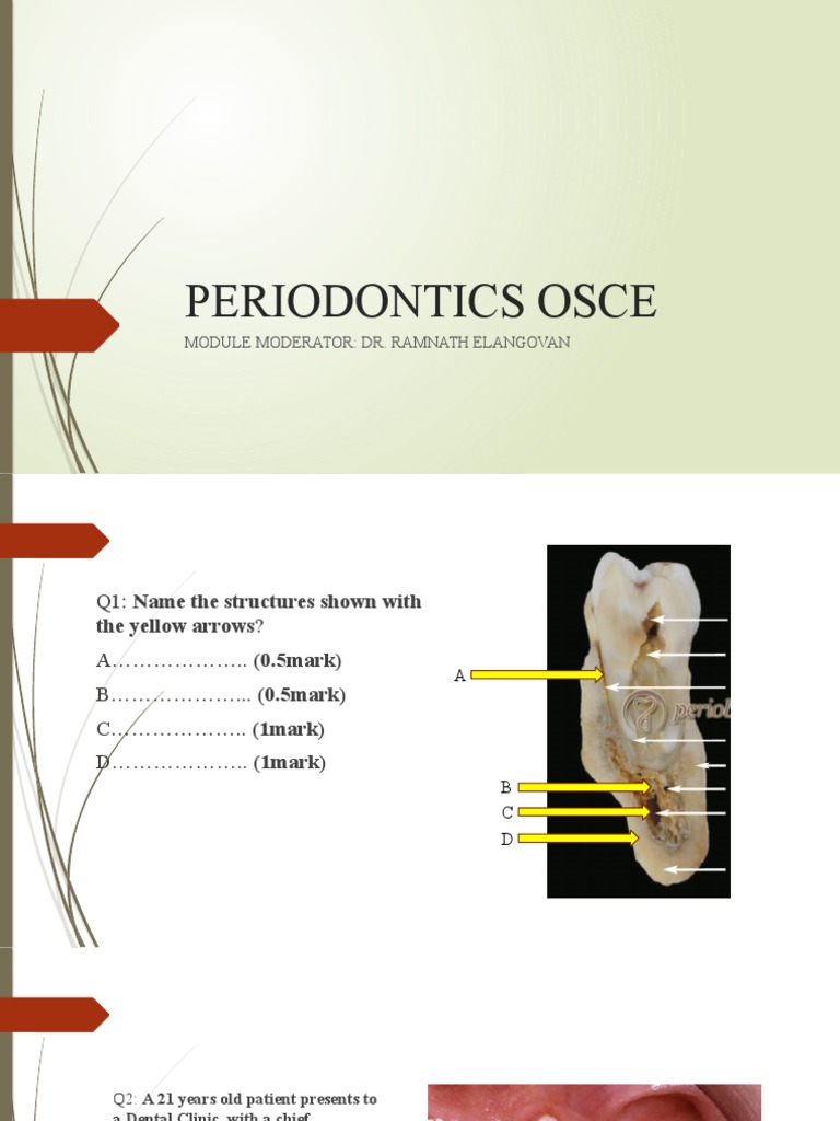 Periodontics OSCE Exam Questions | PDF