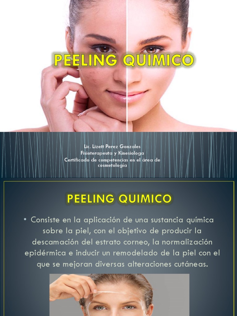 Peeling Quimico | PDF | Piel | Epidermis