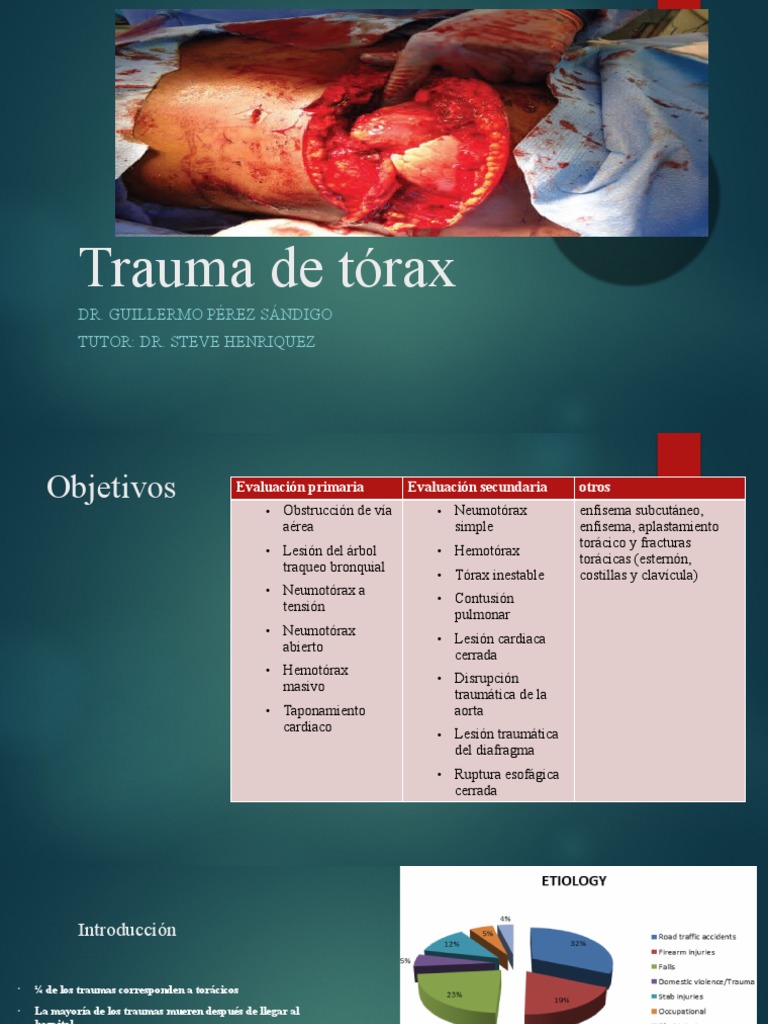 Trauma de Tórax | PDF | Lesión | Causas de la muerte