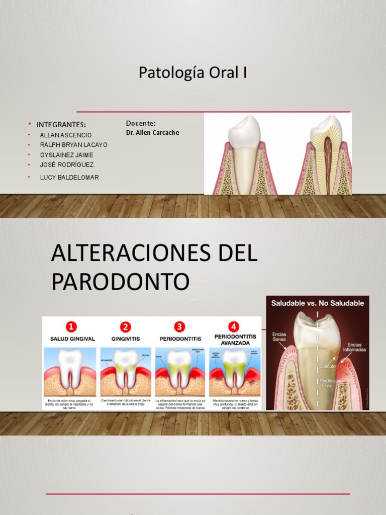Alteraciones Del Parodonto Terminado | PDF | Ciencias de la Salud ...