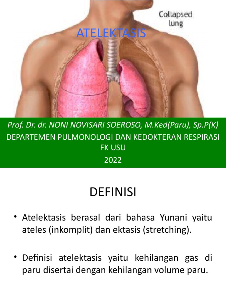 Panduan Lengkap Atelektasis | PDF
