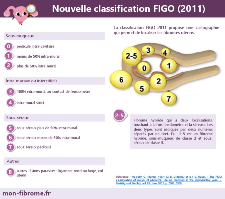Classification FIGO | PDF