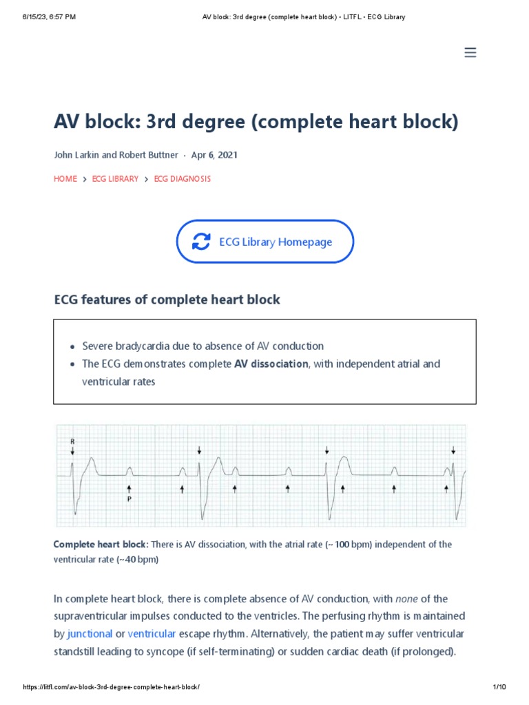AV Block - 3rd Degree (Complete Heart Block) - LITFL - ECG Library | PDF AV Block - 3rd Degree (Complete Heart Block) - LITFL - ECG Library | PDF
