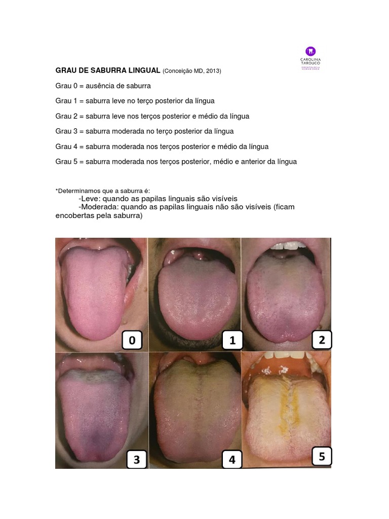 Grau de Saburra Lingual | PDF