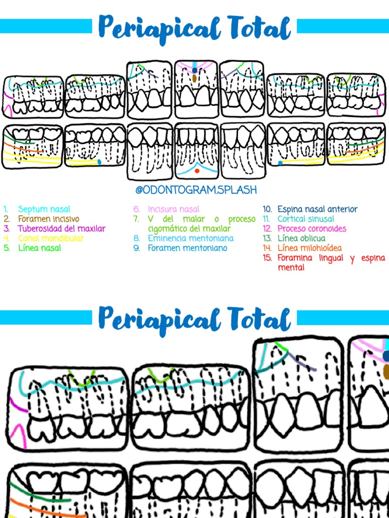 Imagenelogía 2 - Odontogram - Splash | PDF
