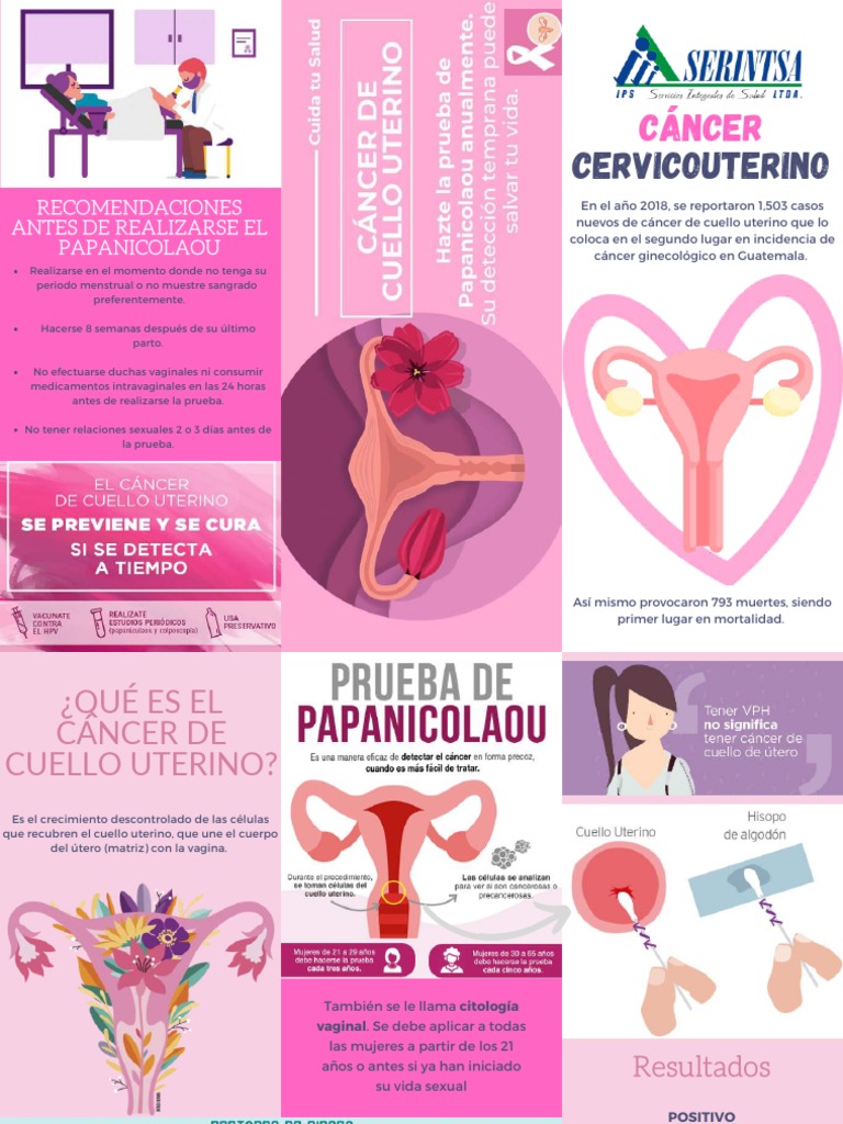Cancer Cervicouterino | PDF