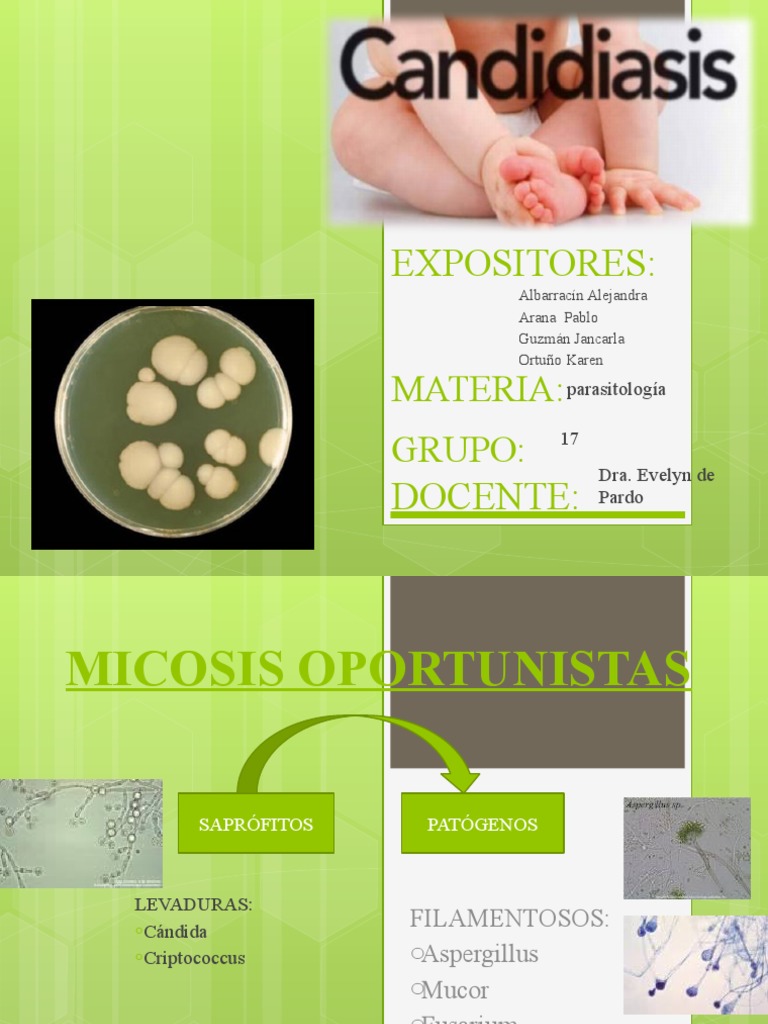 Candidiasis Oral: Diagnóstico y Tratamiento | PDF | Candidiasis ...