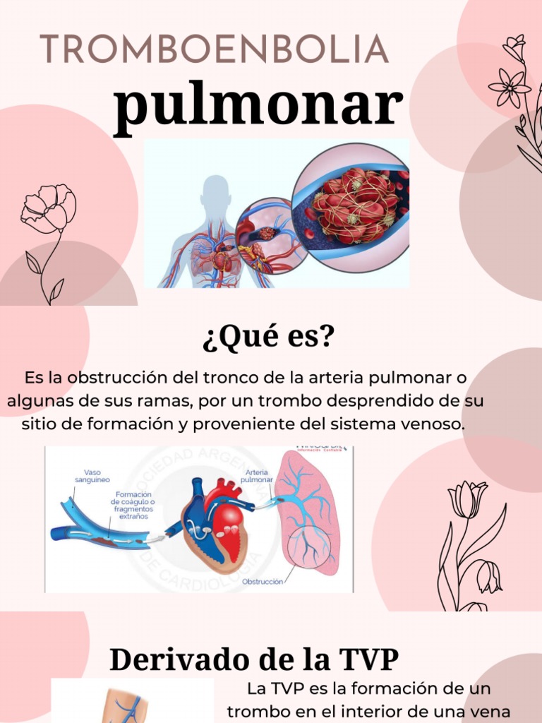 Tromboembolia Pulmonar | PDF