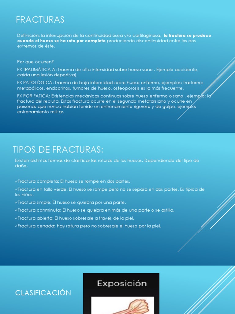 Fracturas y Tratamientos | PDF | Hueso | Codo