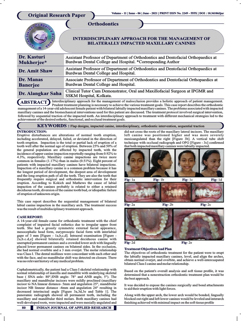 Interdisciplinary Approach For The Management Of Bilaterally Impacted