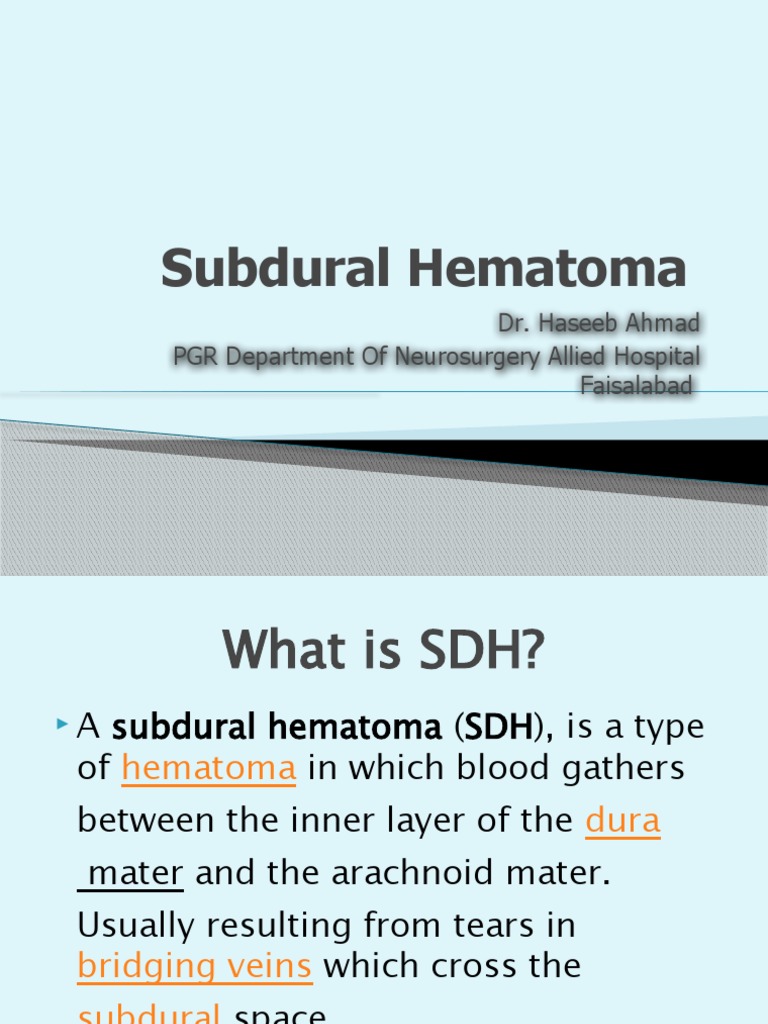 SDH and Its Management | PDF