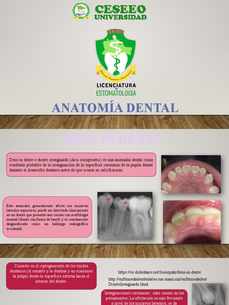 Dens in Dente | PDF | Diente | Especialidades Medicas