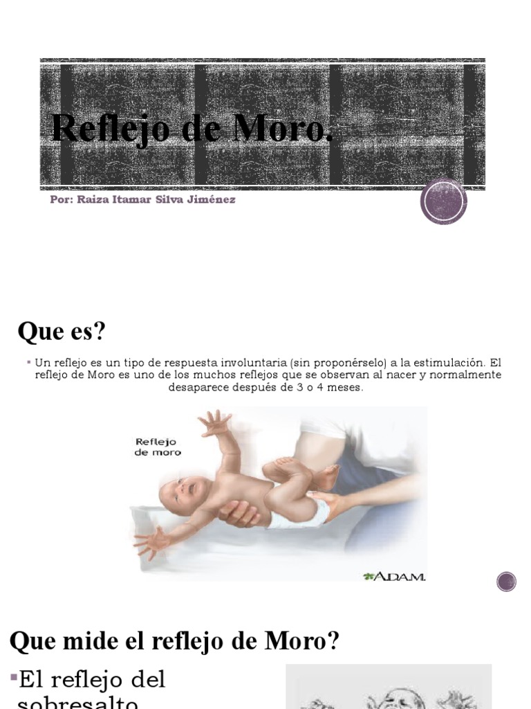 Reflejo de Moro | PDF