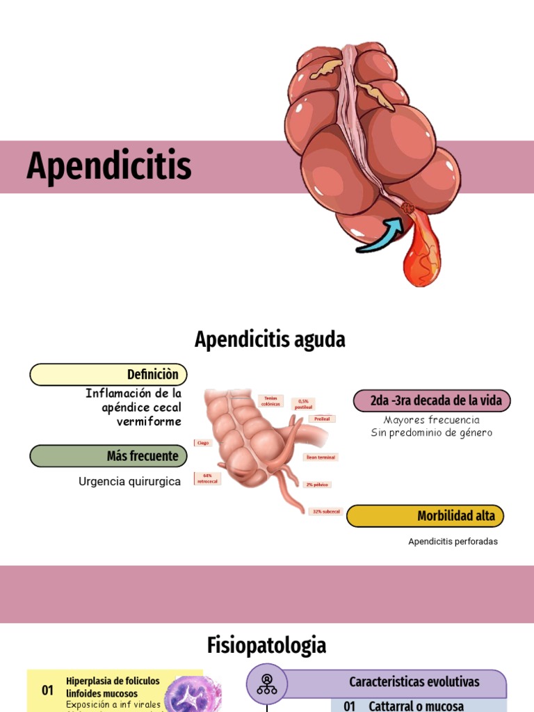 Apendicitis y Oclusion Intestina | PDF | Epidemiología | Síntomas y signos